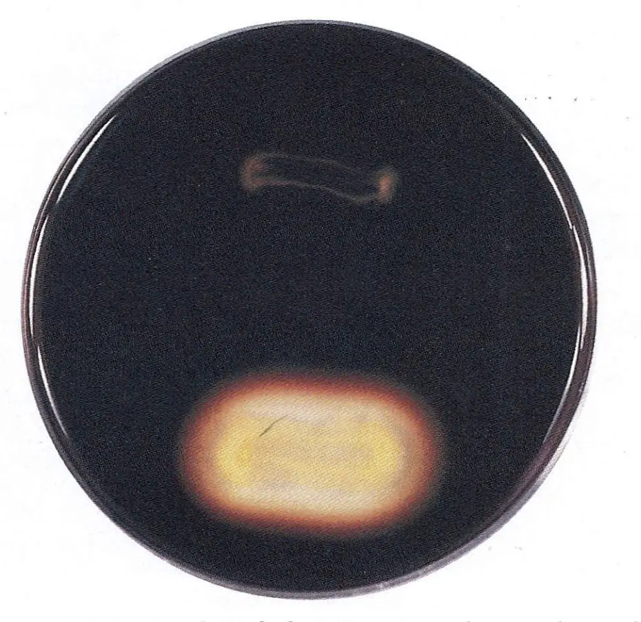 Starch Hydrolysis Test Lectures, Microbiology - on Study Boss