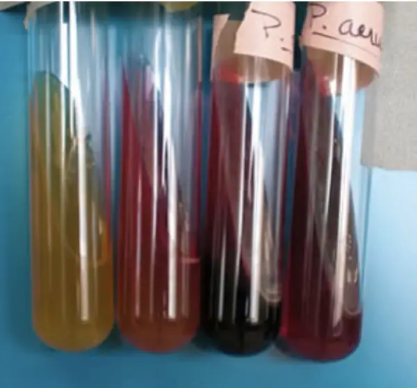 Biochemical Tests: Gram Positive and gram Negative Bacteria Assignment ...